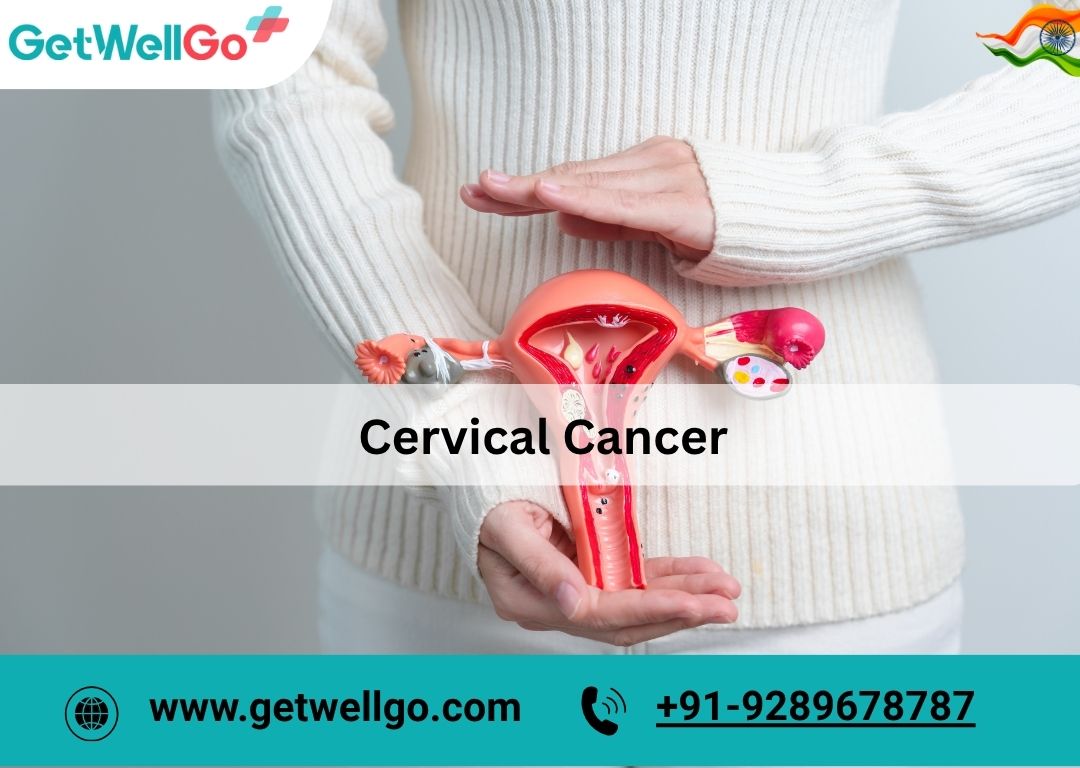 Early Cervical Cancer Signs Top 10 Every Woman Should Know